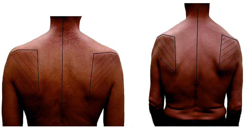 Injury Prevention | Para-Swimming | British Swimming